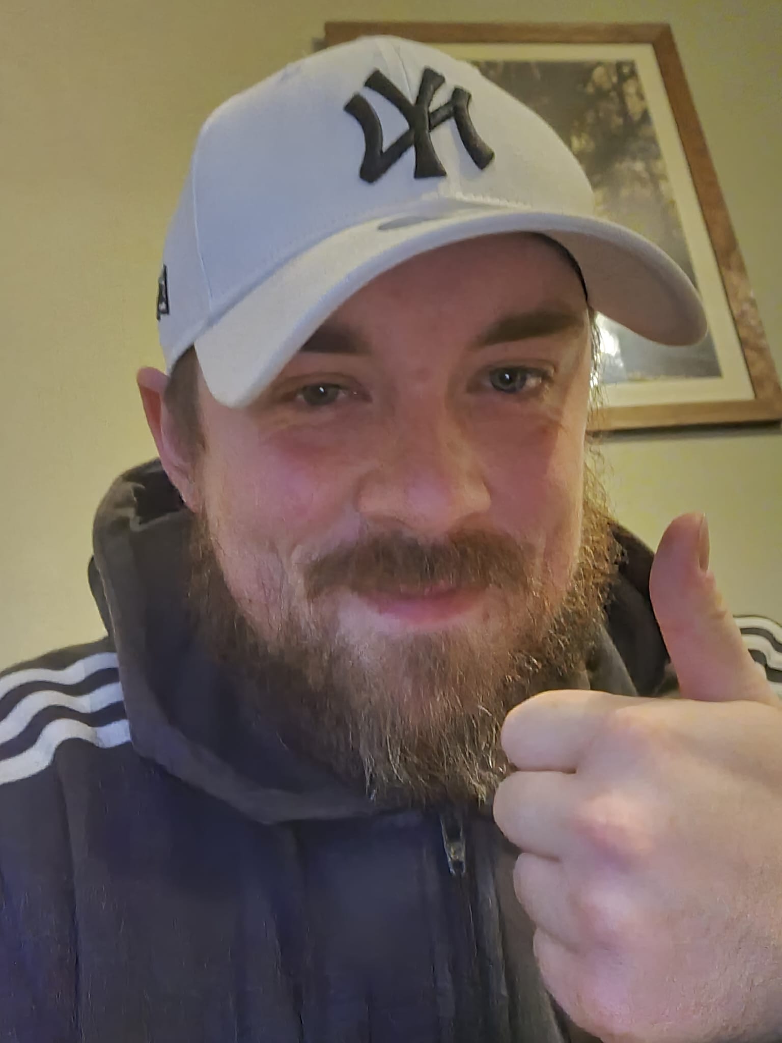 Hope Brake Set - Dream Bike Competition